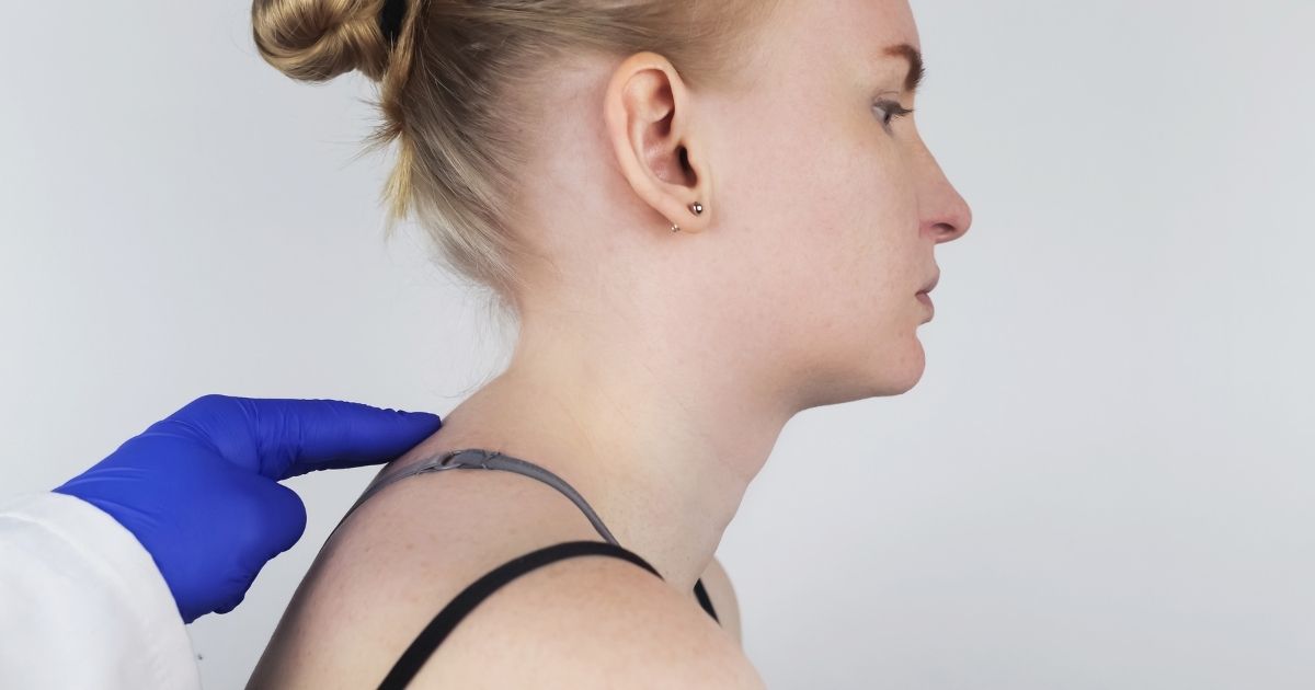 What is Kyphosis: Causes and Prevention | Moyer Total Wellness