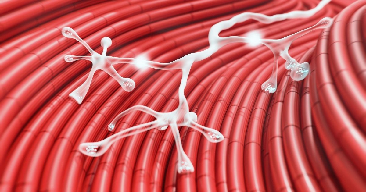 Types of Pain Part 3: Nerve Pain | Moyer Total Wellness